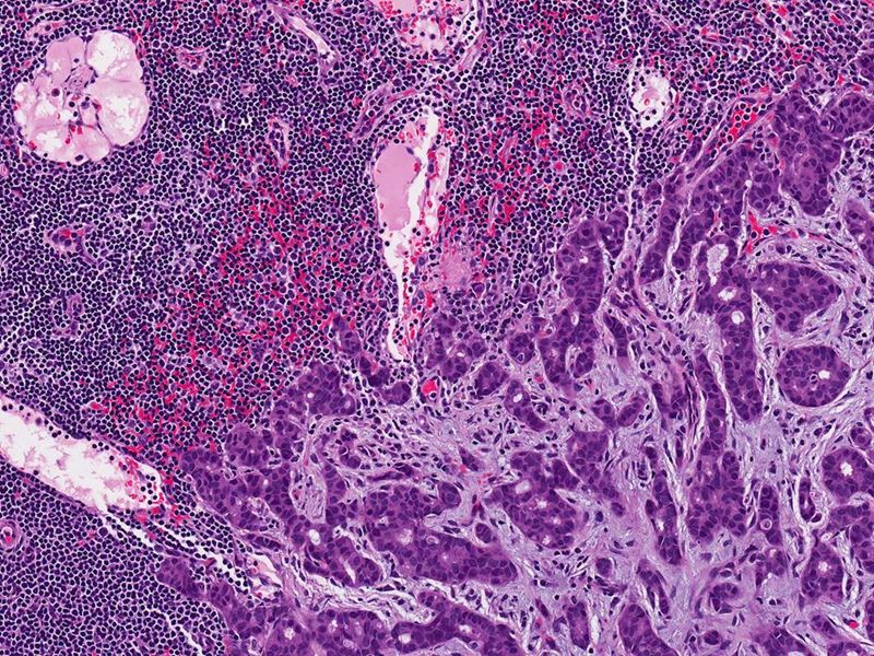 Newsroom | College of American Pathologists : New CAP Publication ...