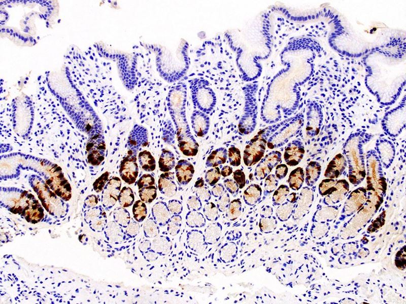 Newsroom | College of American Pathologists : CAP Opens Updated Draft ...
